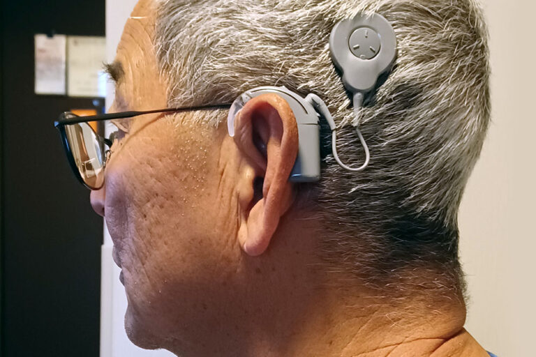 Cochlear Implant Returns Patient’s Hearing - Keck Medicine of USC