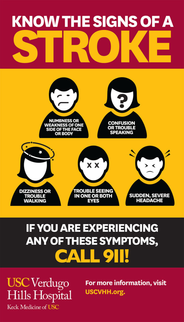 5 Warning Signs of a Stroke | Keck Medicine of USC